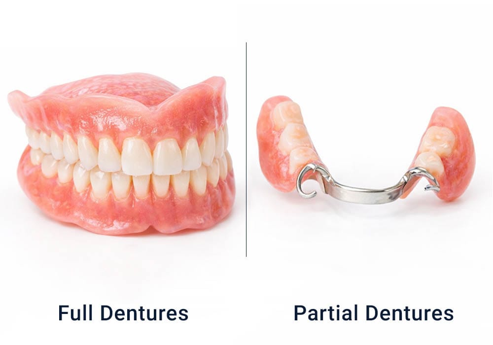 Dentures Sheepshead Bay, Brooklyn | Full or Partial Dentures on Ave X ...